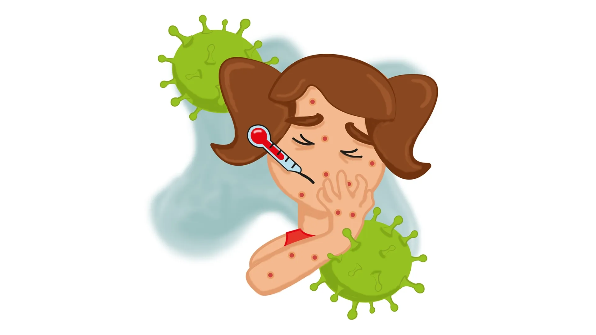 UNAM alerta brote de sarampión: conoce cómo prevenirlo